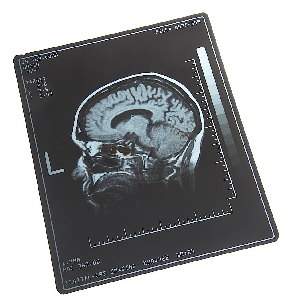 Alias (TV) - Will's Head X-Ray (Bradley Cooper)