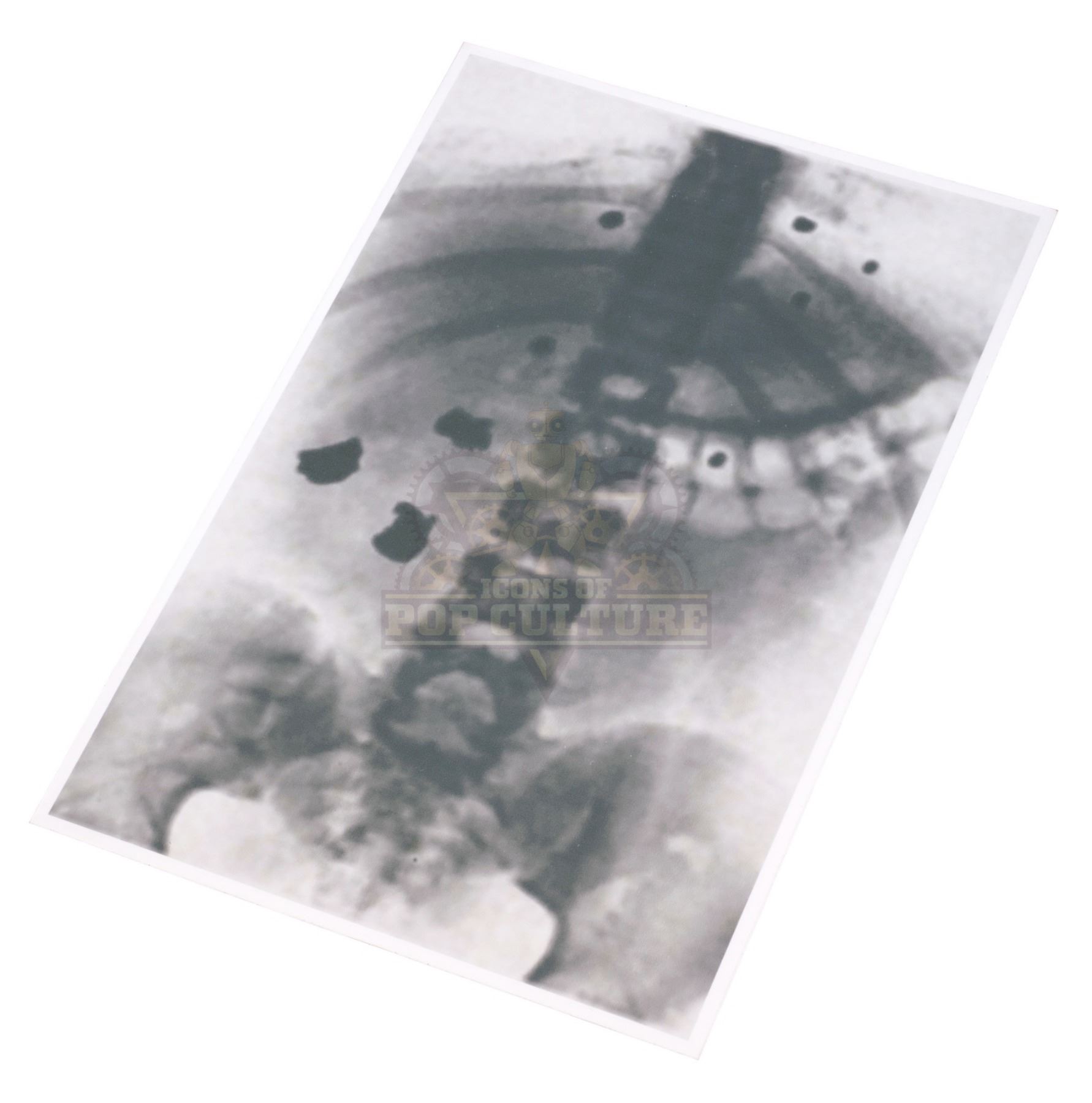 Timeless (TV) – Marie Curie’s “Nicholas Keynes Shrapnel” X-Ray – TL127