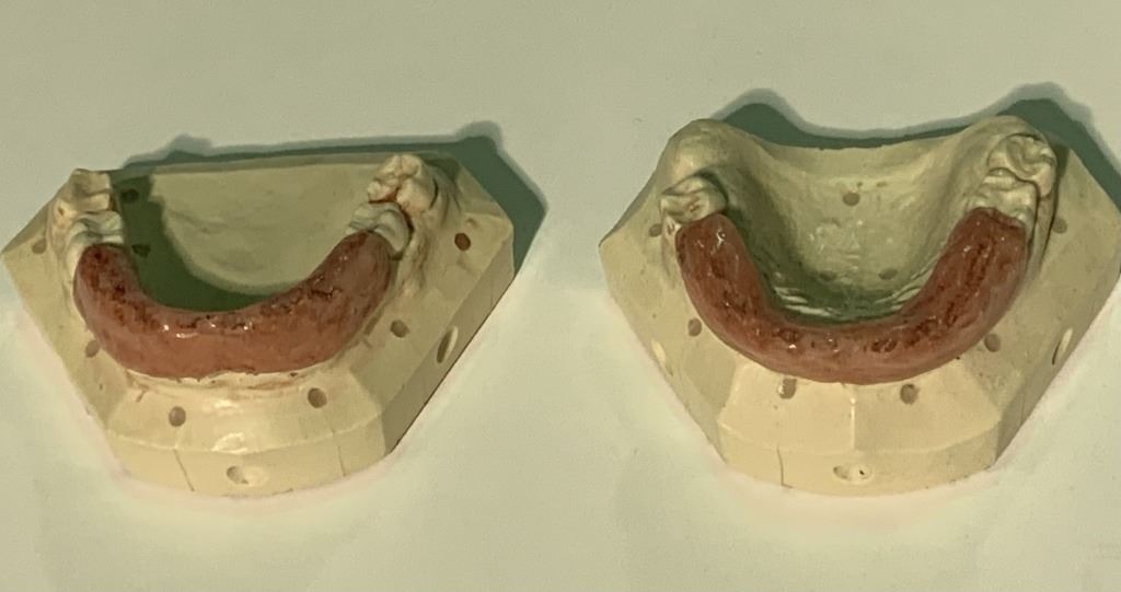 Doctor Sleep (2019) - Mrs. Massey (Sallye Hooks) Upper And Lower Bloody ...