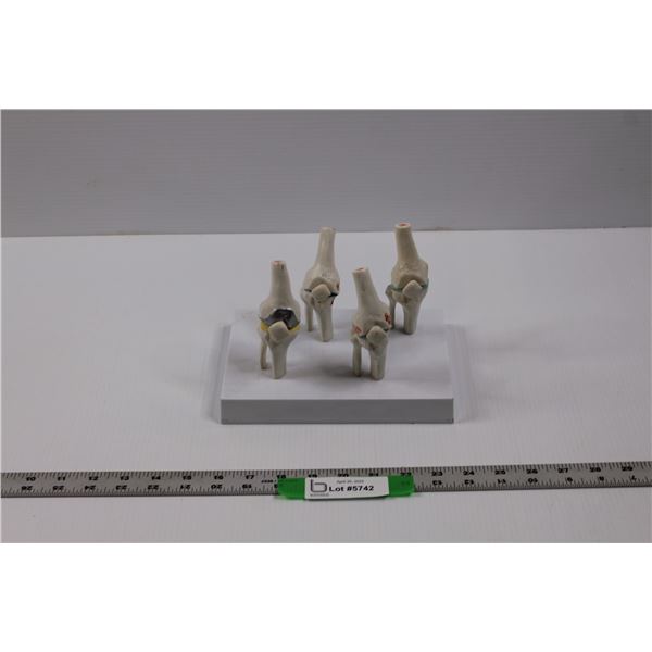 Medical Joint Display - Bodnarus Auctioneering Medical Joint Display - Bodnarus Auctioneering