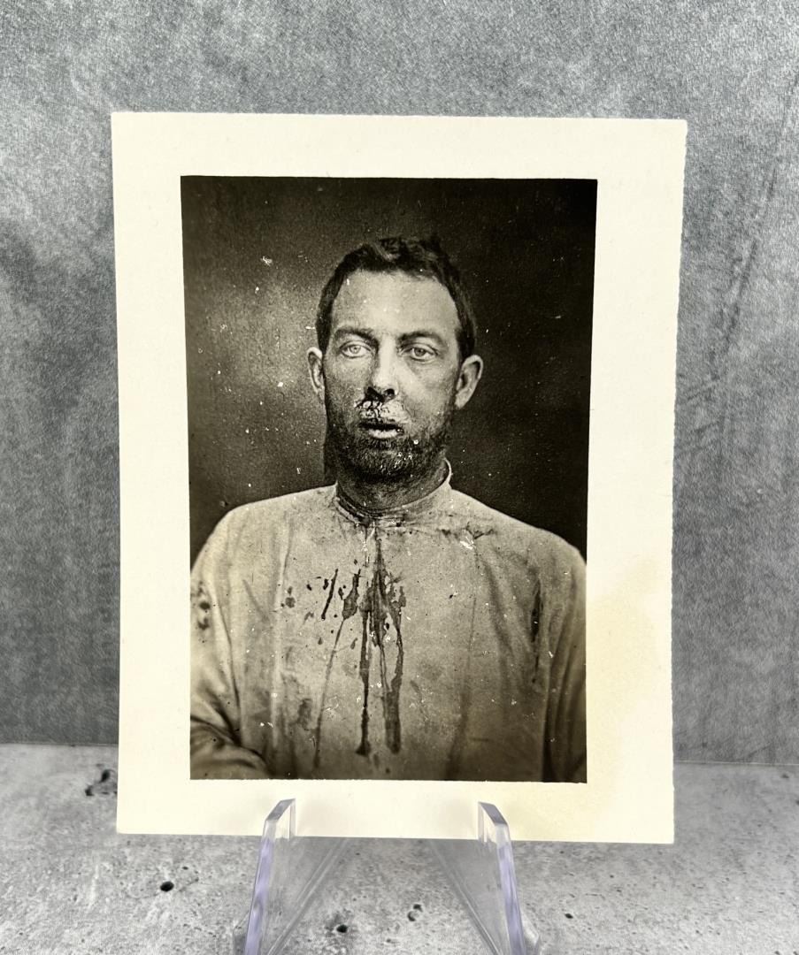 James Younger Gang Member Jim Younger Photo