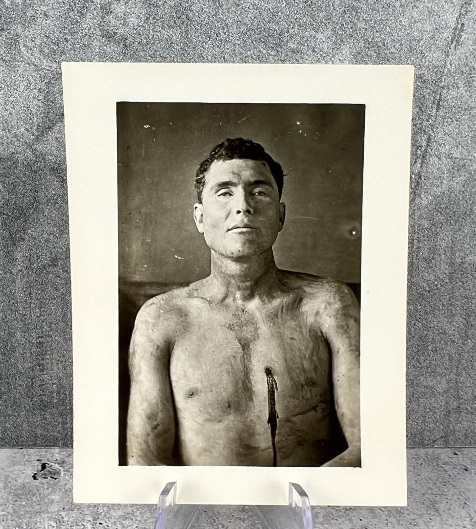 James Younger Gang Member Bill Stiles Death Photo