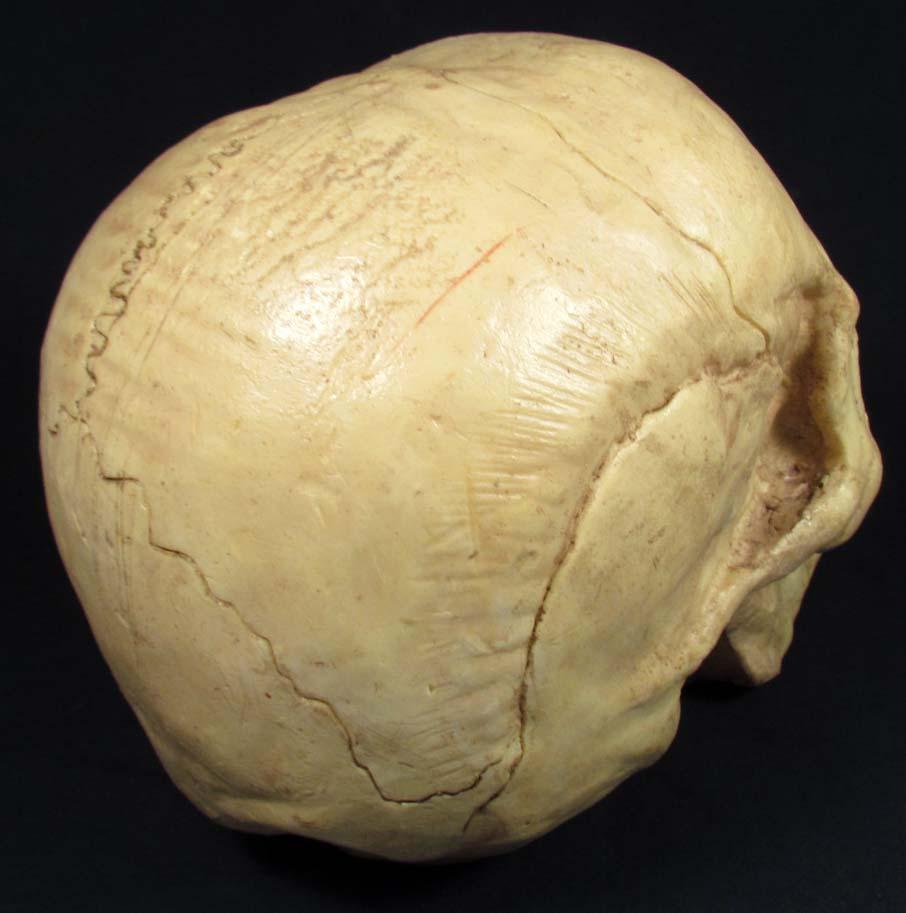 VINTAGE MEDICAL PLASTIC HUMAN SPECIMEN SKULL - App